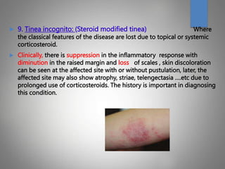 Superficial fungal skin infections.ppt