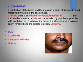Superficial fungal skin infections.ppt