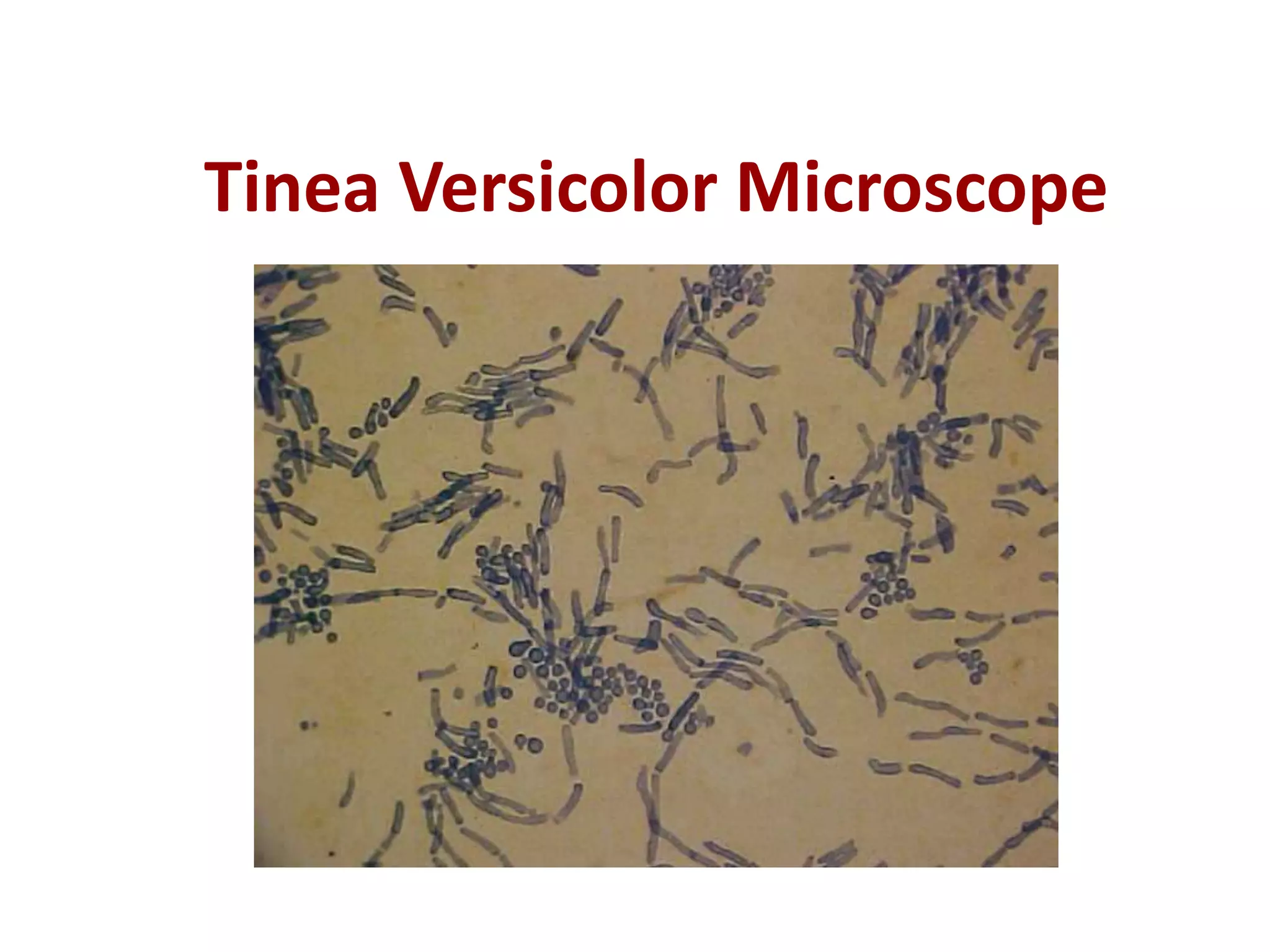 Superficial mycoses | PPTX