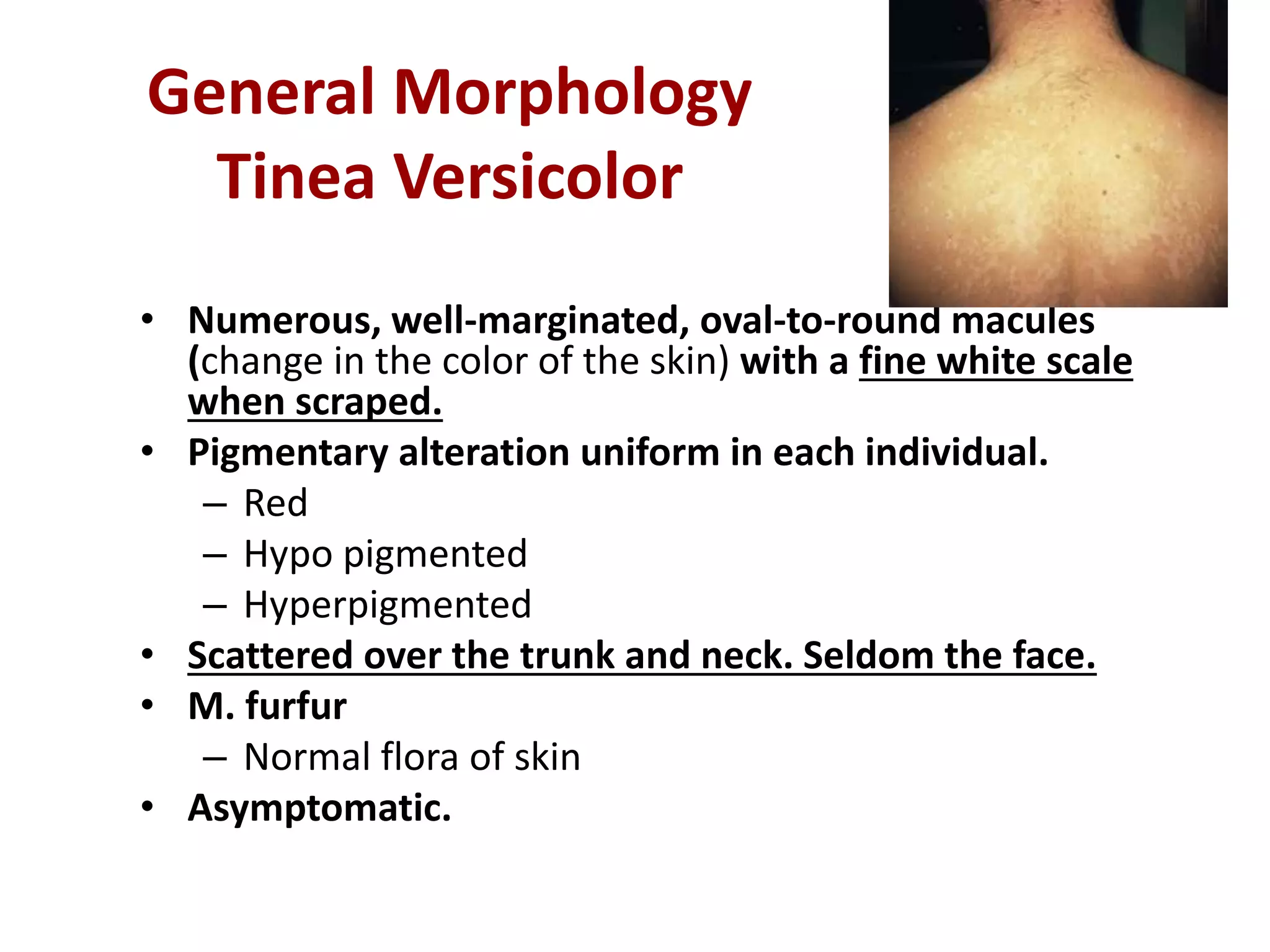 Superficial mycoses | PPTX