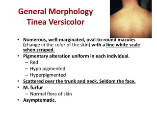 Superficial mycoses | PPTX