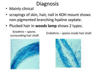 Superficial mycoses | PPTX