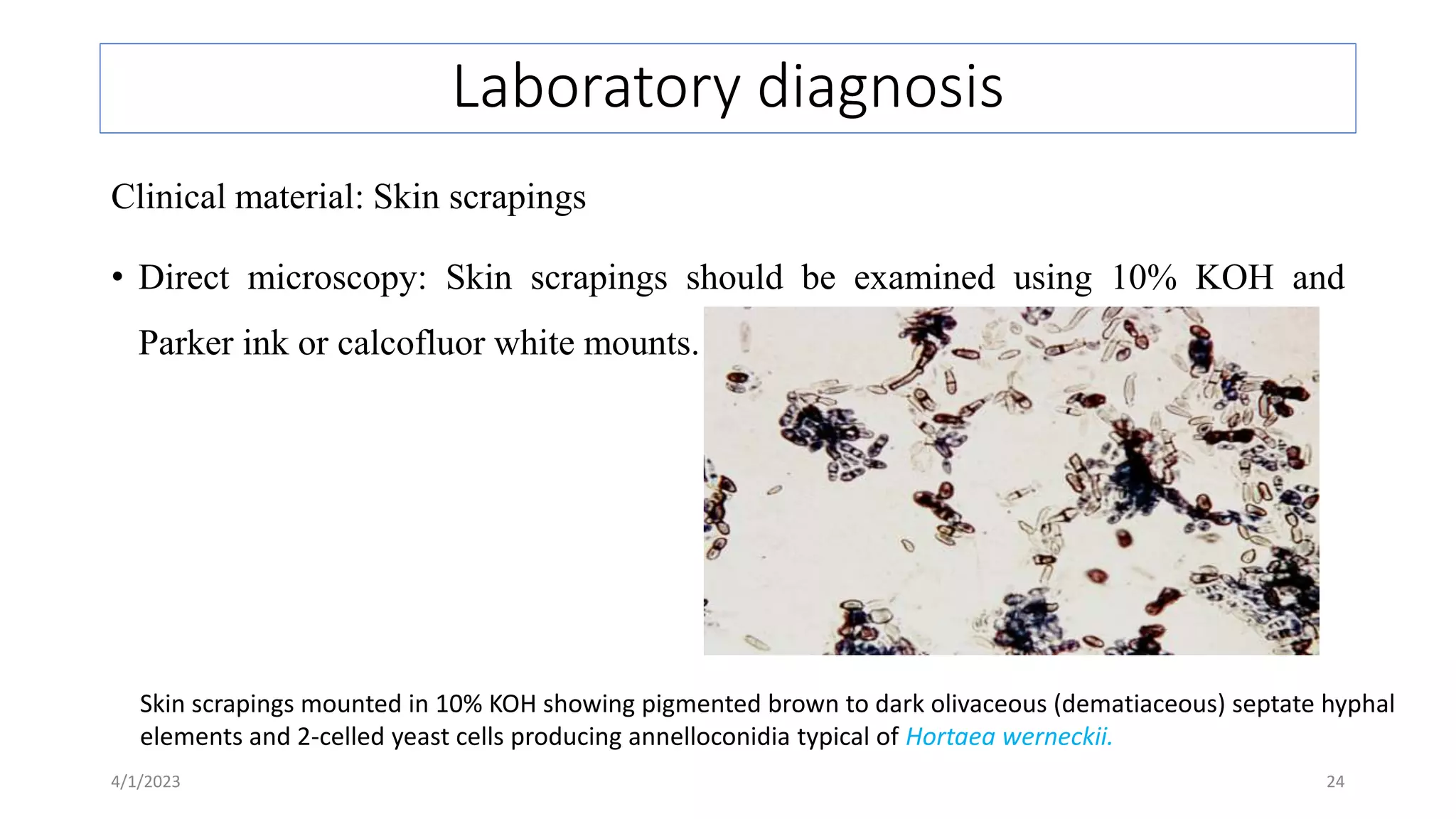 Superficial Mycoses.pptx