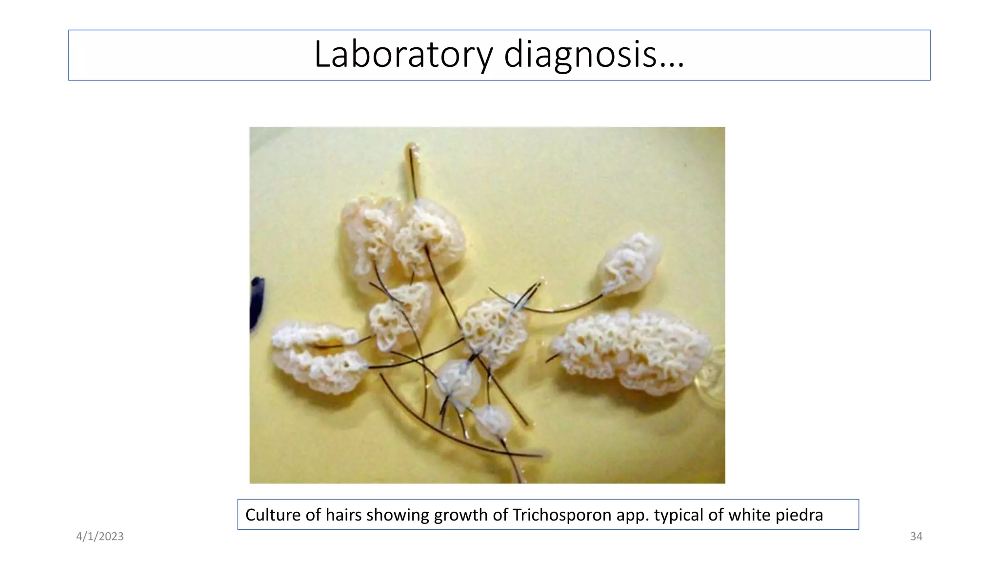Superficial Mycoses.pptx