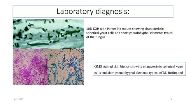 Superficial Mycoses.pptx