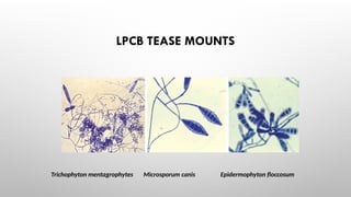 An overview of Superficial Mycoses.pptx