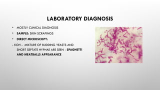 An overview of Superficial Mycoses.pptx