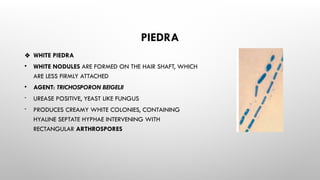 An overview of Superficial Mycoses.pptx