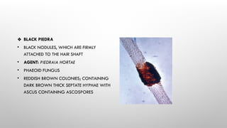 An overview of Superficial Mycoses.pptx