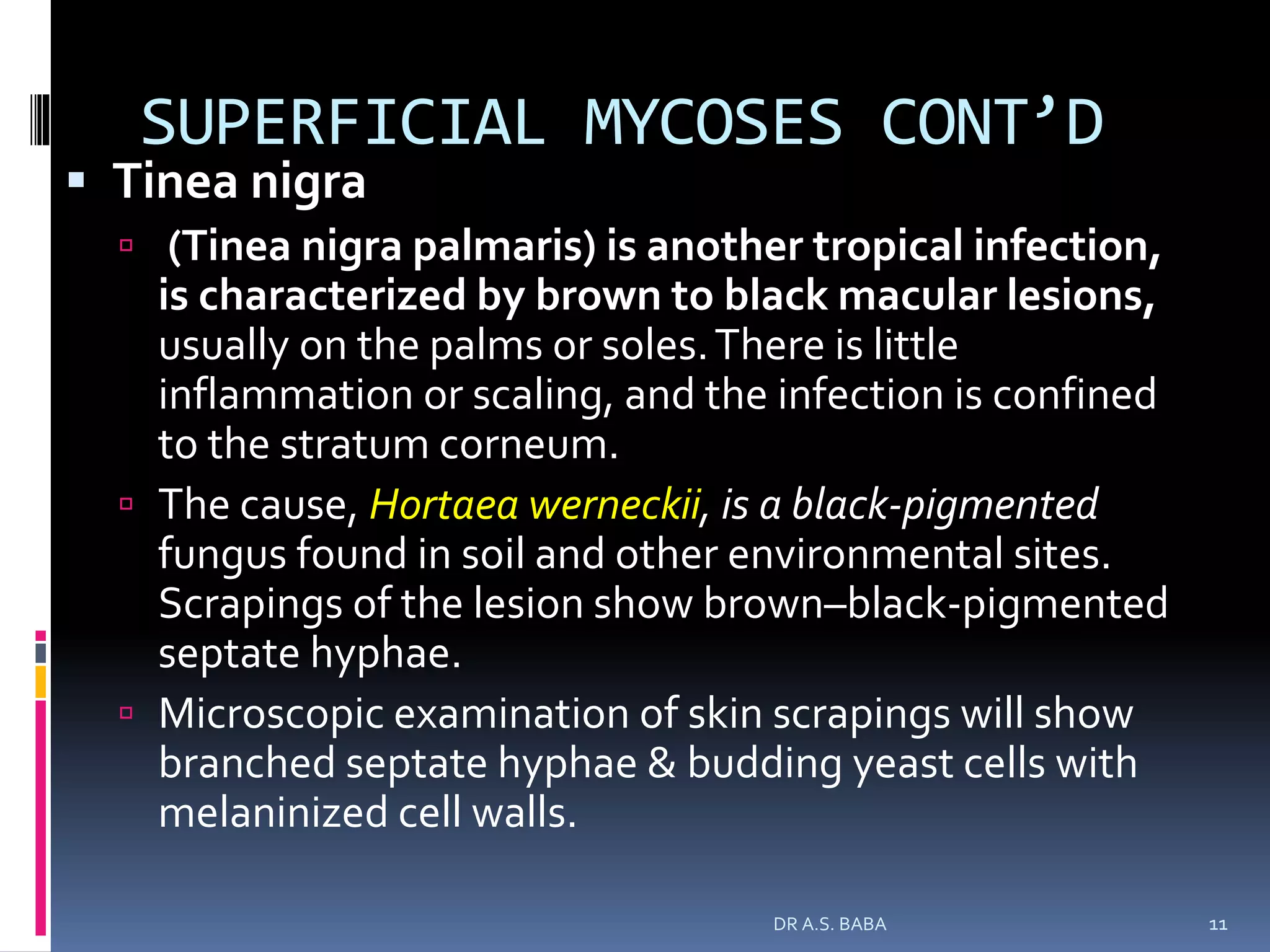 Superficial mycoses mbbs v | PPTX