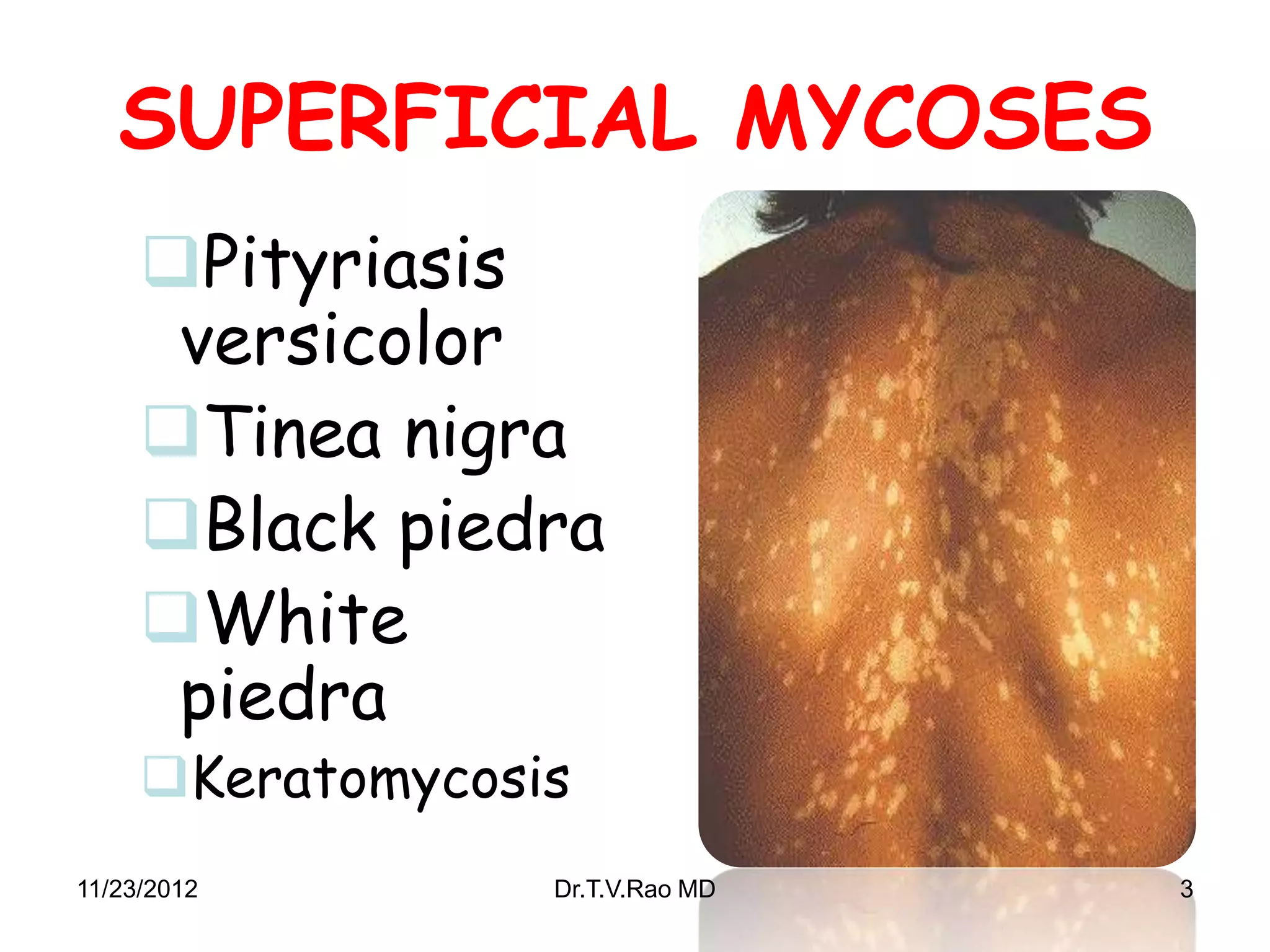 Superficial Fungal Infections | PPTX