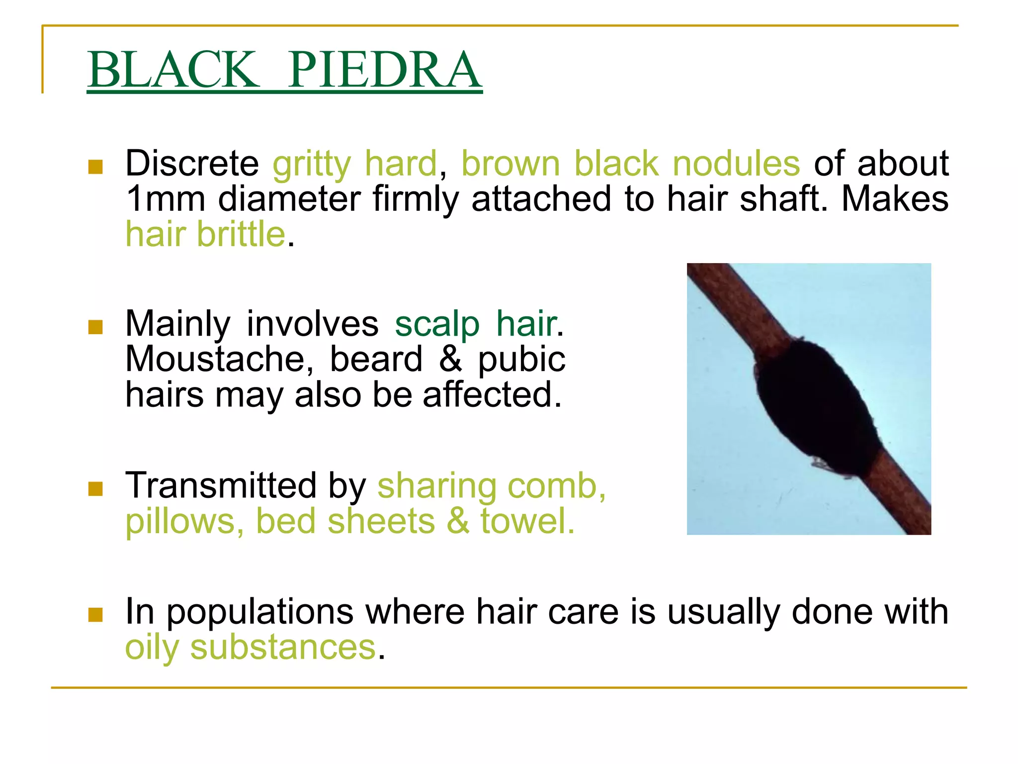 Superficial mycosis | PPTX