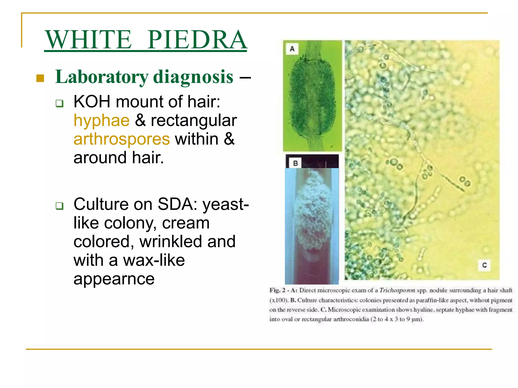 Superficial mycosis | PPTX