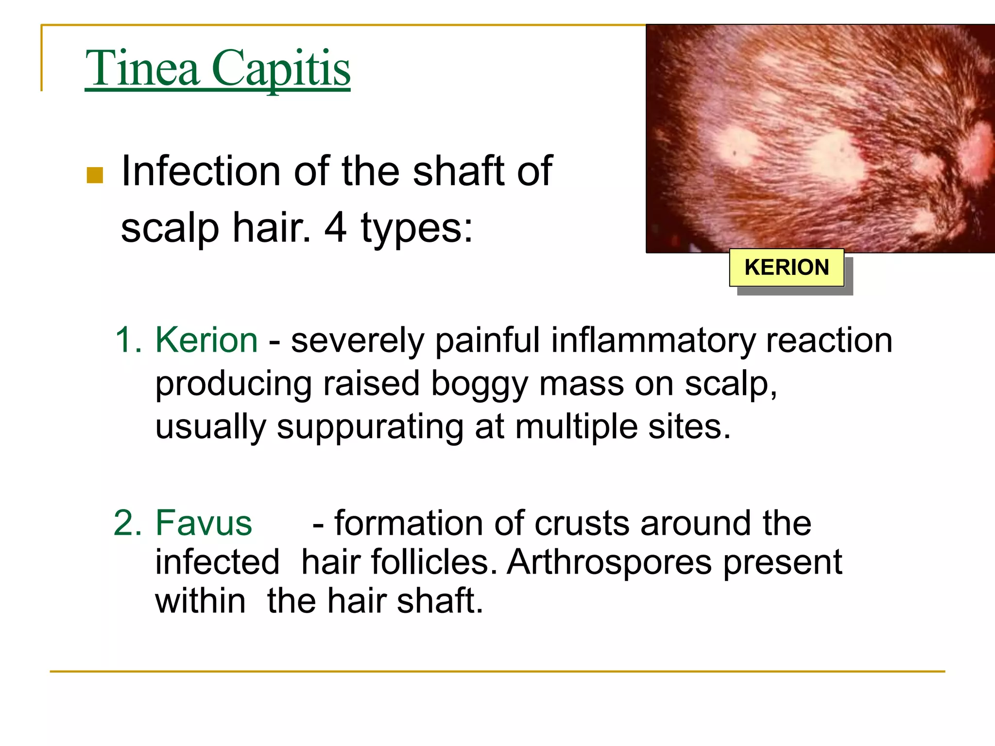 Superficial mycosis | PPTX