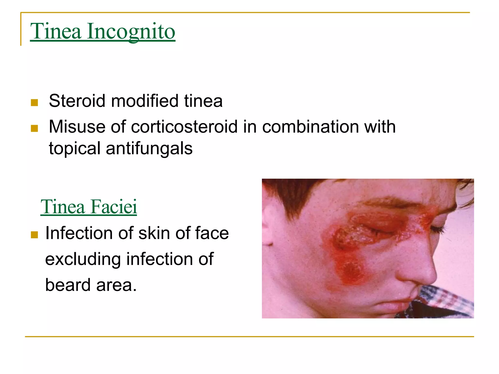 Superficial mycosis | PPTX