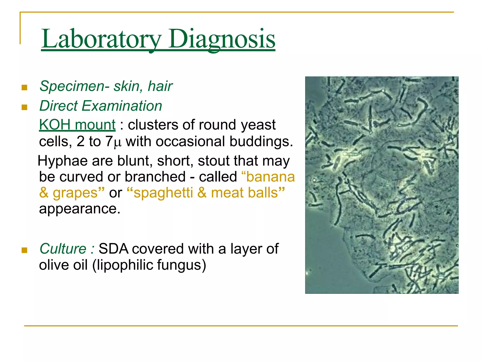 Superficial mycosis | PPTX