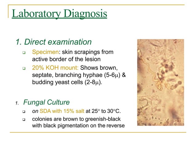 Superficial mycosis | PPTX | Skin and Dermatology | Diseases and Conditions