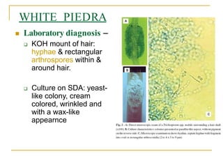 Superficial mycosis | PPTX