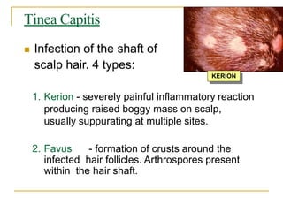 Superficial mycosis | PPTX