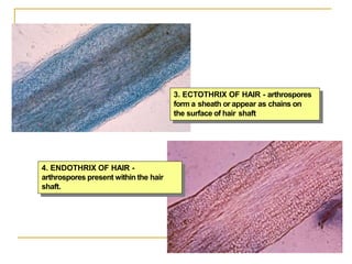 Superficial mycosis | PPTX