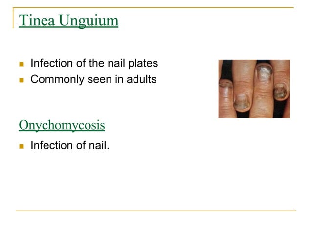 Superficial mycosis | PPTX | Skin and Dermatology | Diseases and Conditions