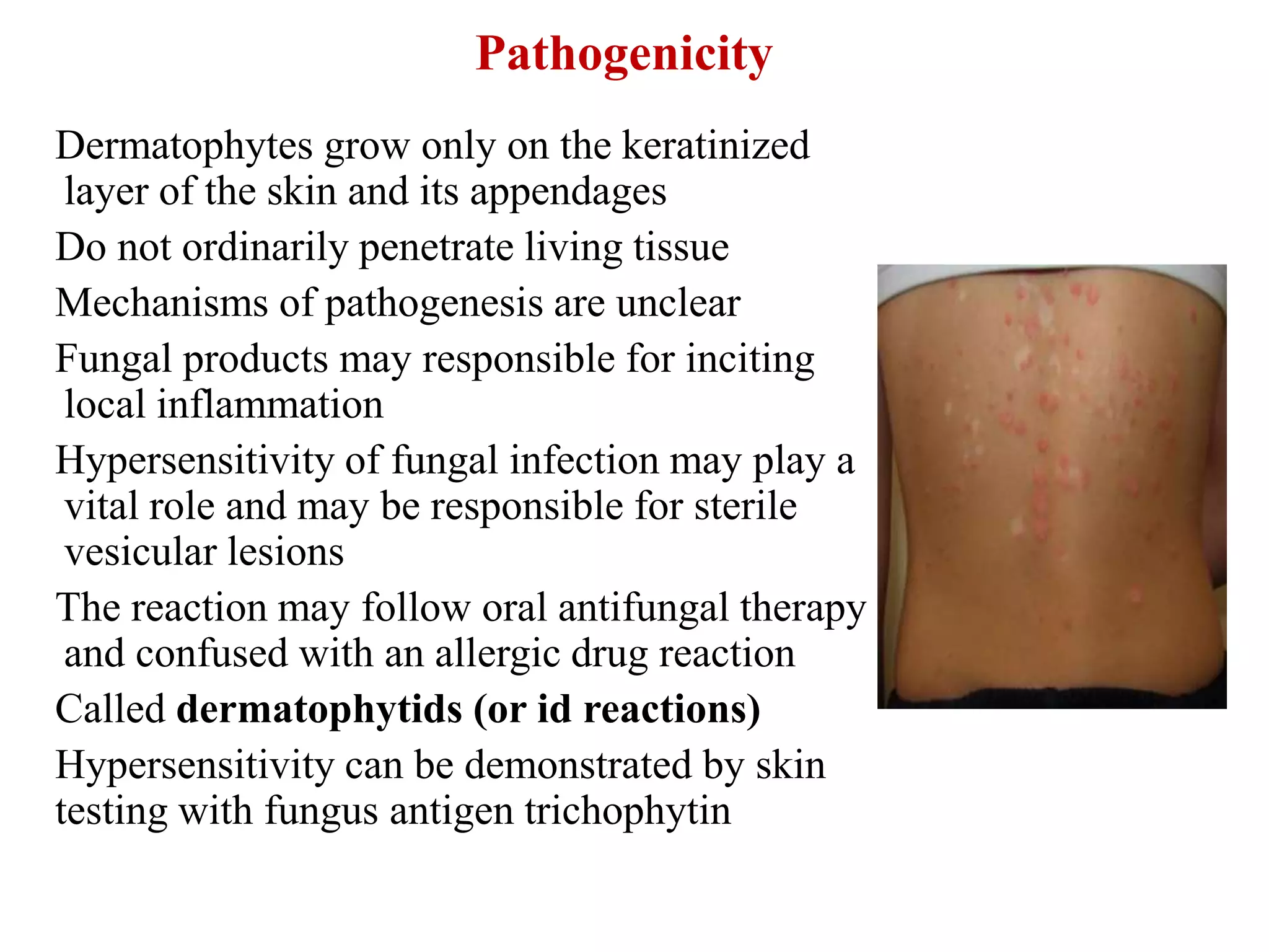 Superficial Mycosis.pptx