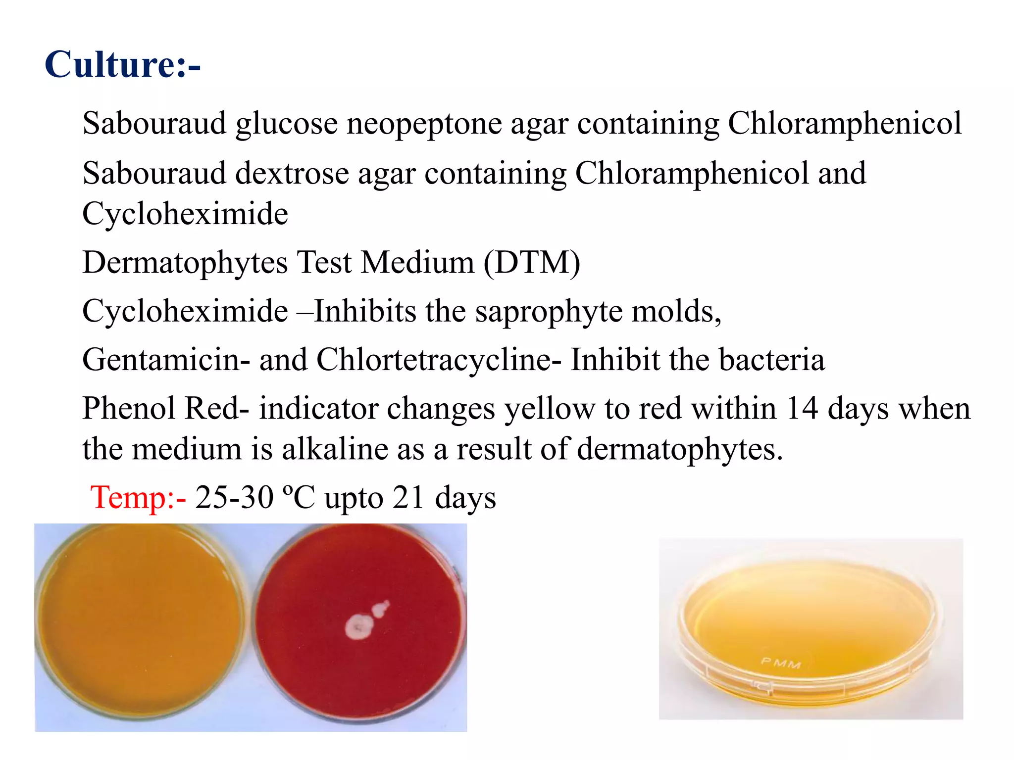 Superficial Mycosis.pptx