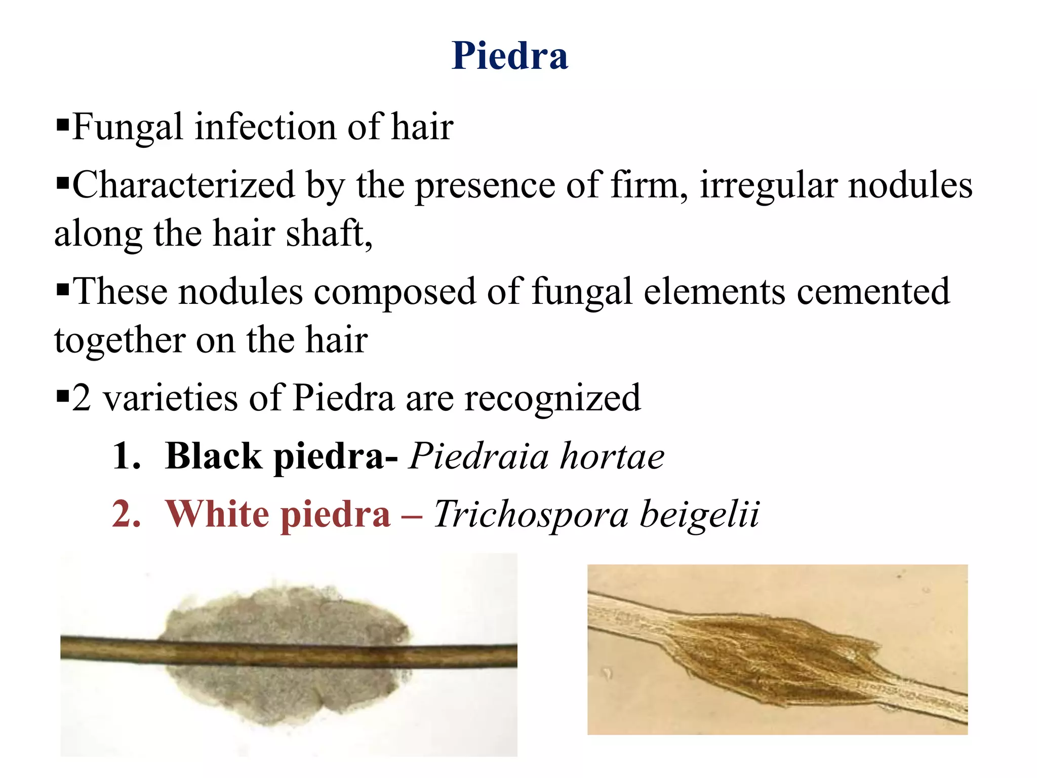 Superficial Mycosis.pptx