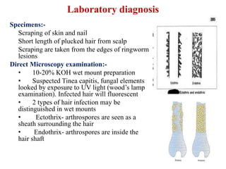 Superficial Mycosis.pptx