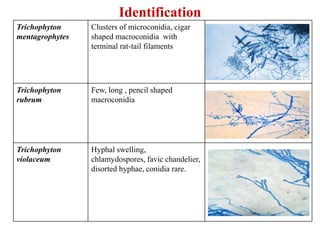 Superficial Mycosis.pptx