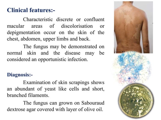 Superficial Mycosis.pptx