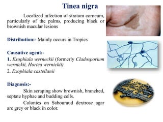 Superficial Mycosis.pptx