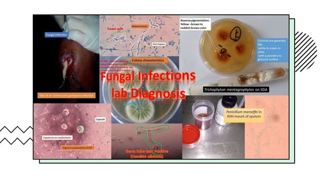 Superficial mycosis-4-1.pptx | Skin and Dermatology | Diseases and ...