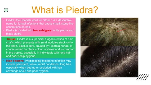 Superficial mycosis-4-1.pptx | Skin and Dermatology | Diseases and ...