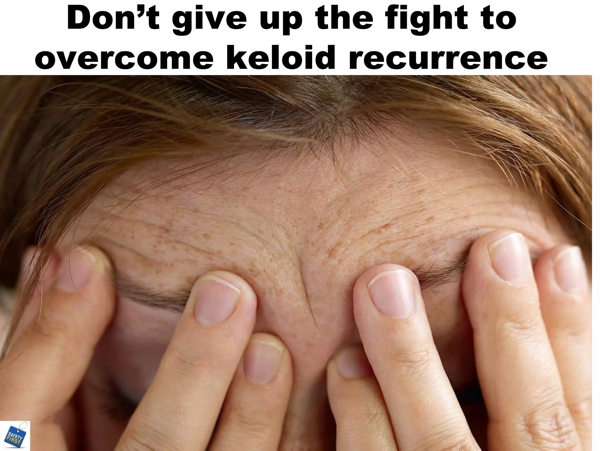 Superficial radiotherapy (sxt)_following_ear_lobe | PPT