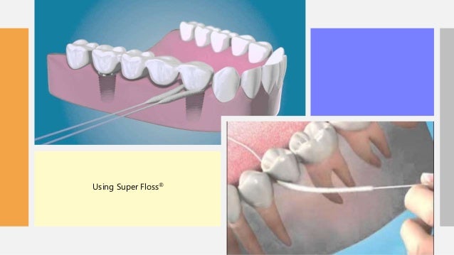 Super Floss and Threaders