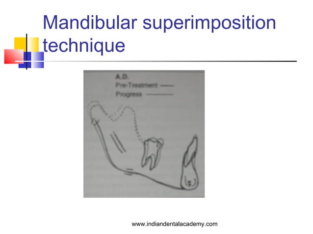 Superimposition techniques | PPT | Oral care | Personal Care