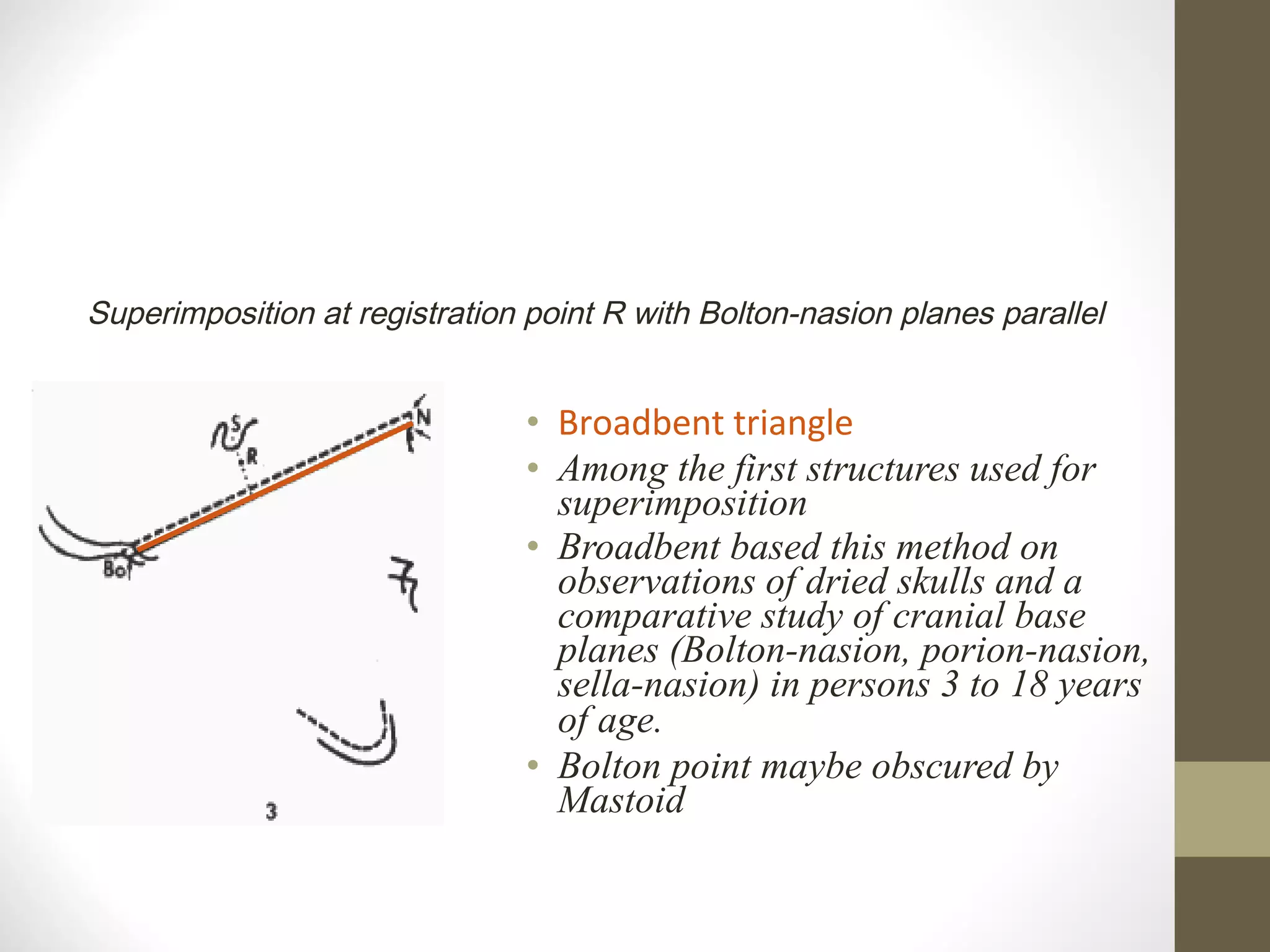 Superimposition techniques | PPT