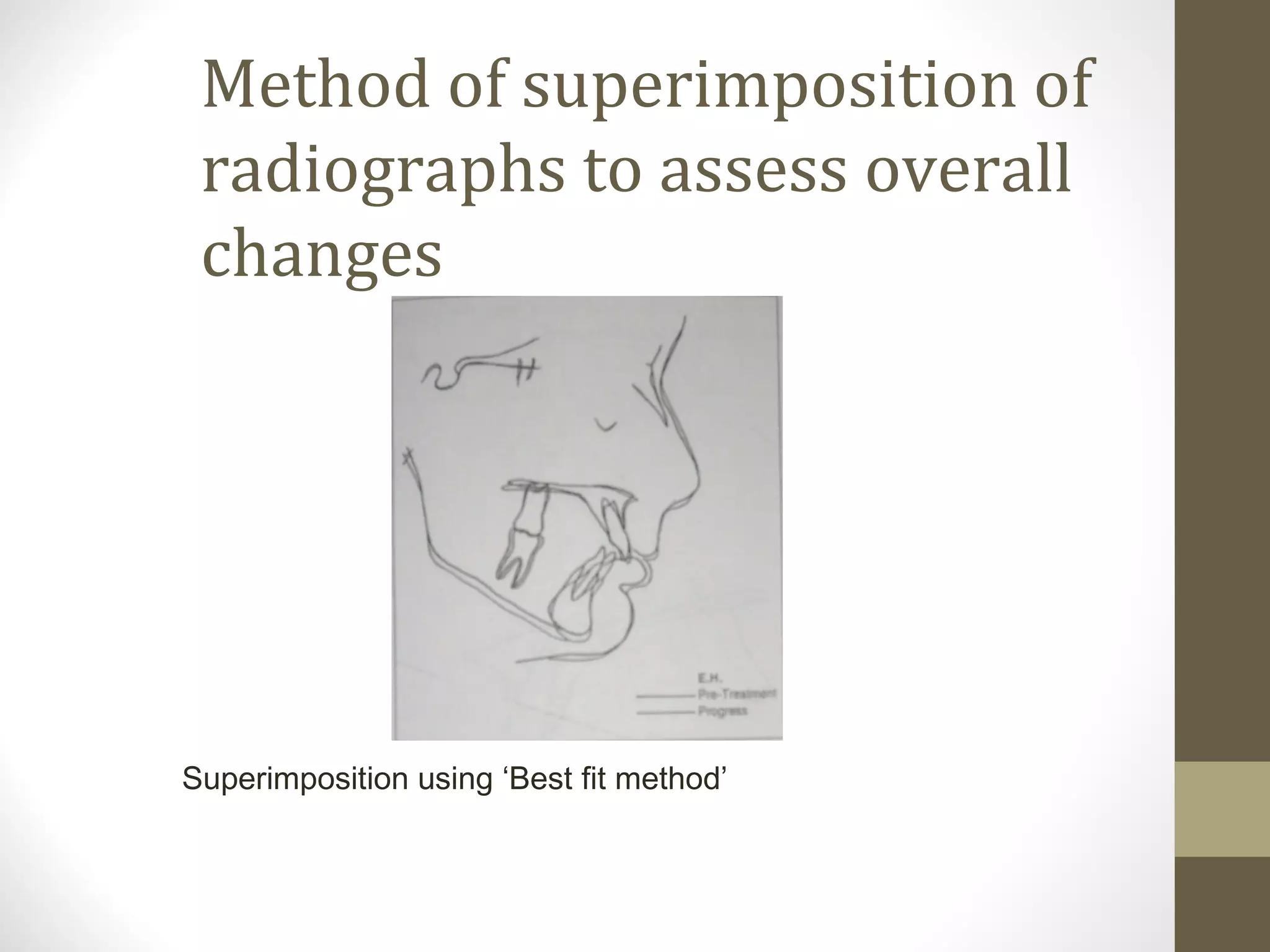 Superimposition techniques | PPT