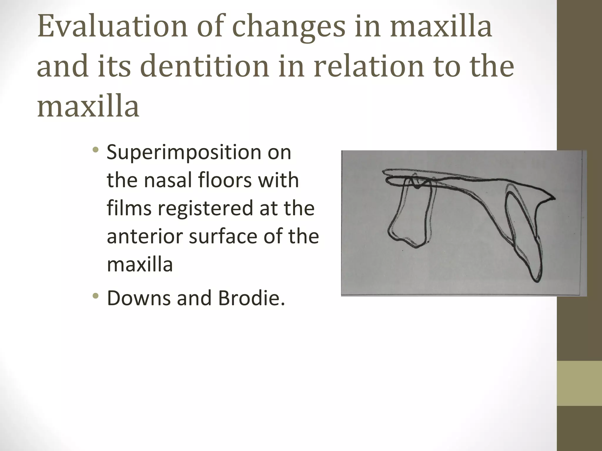 Superimposition techniques | PPT