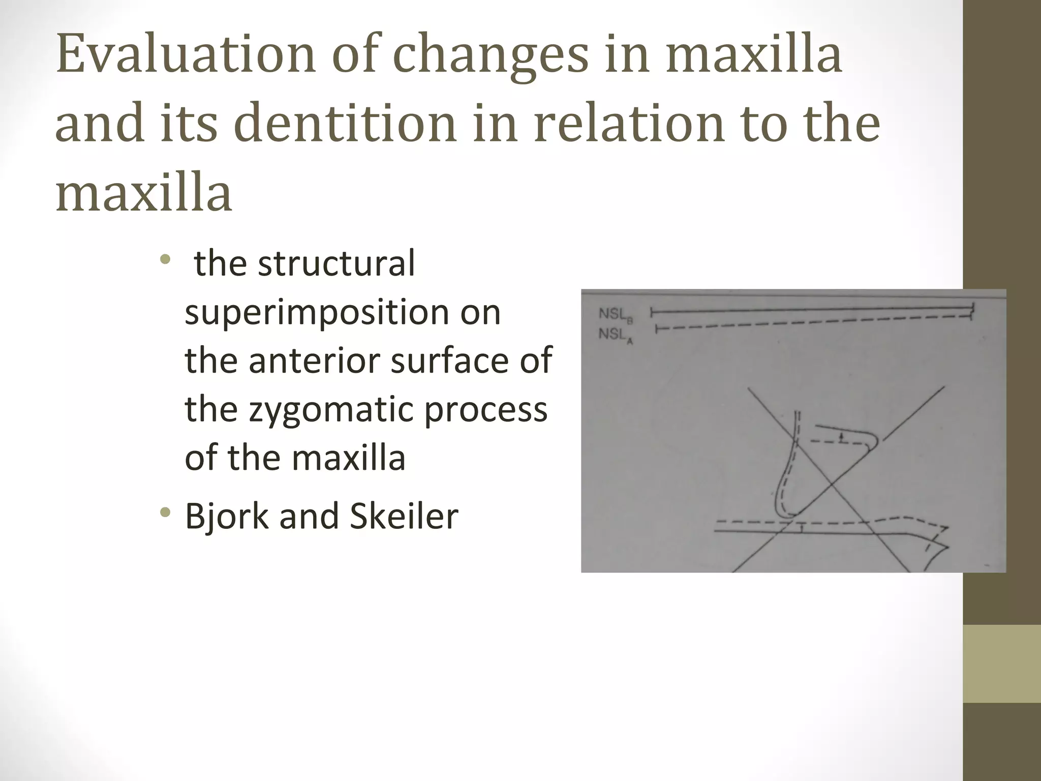 Superimposition techniques | PPT