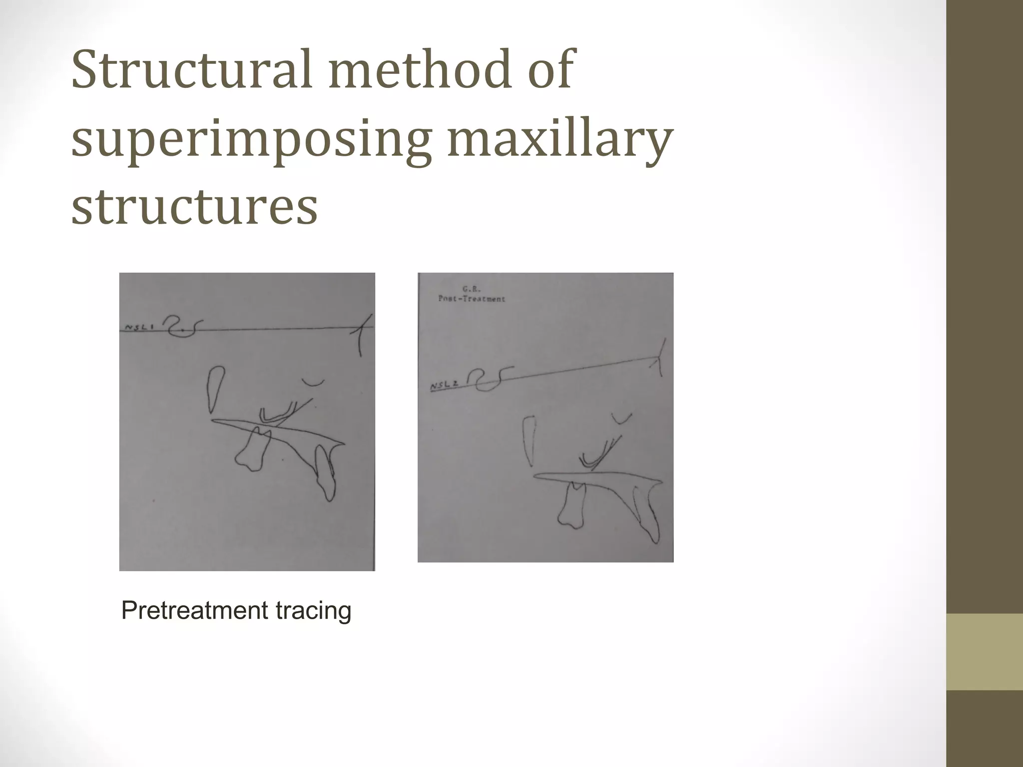 Superimposition techniques | PPT