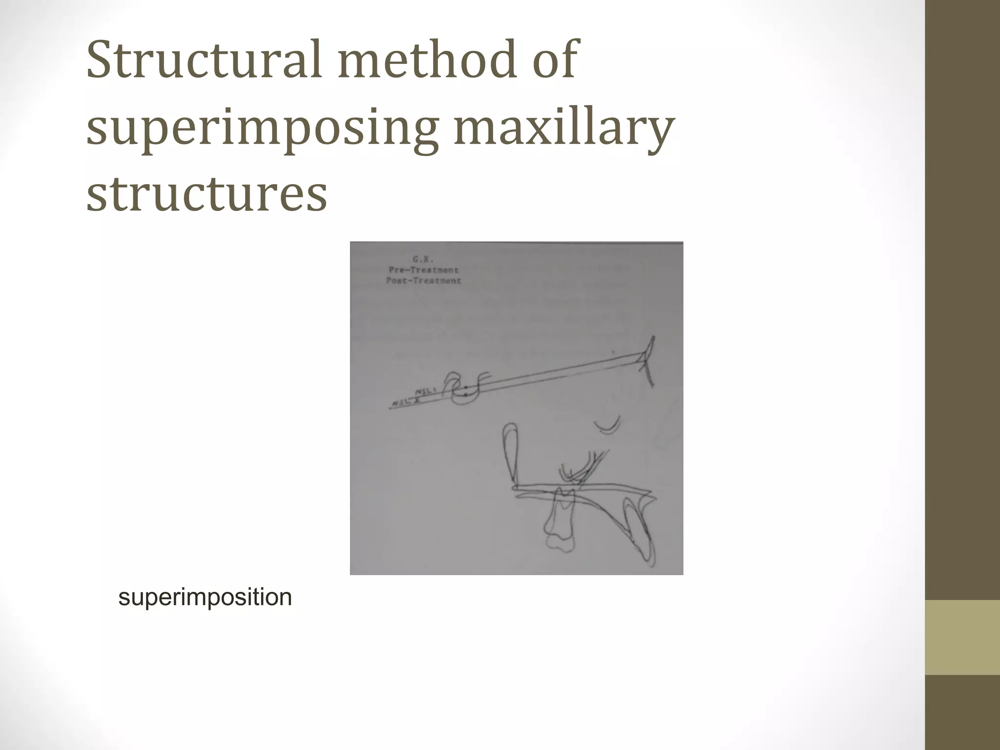 Superimposition techniques | PPT