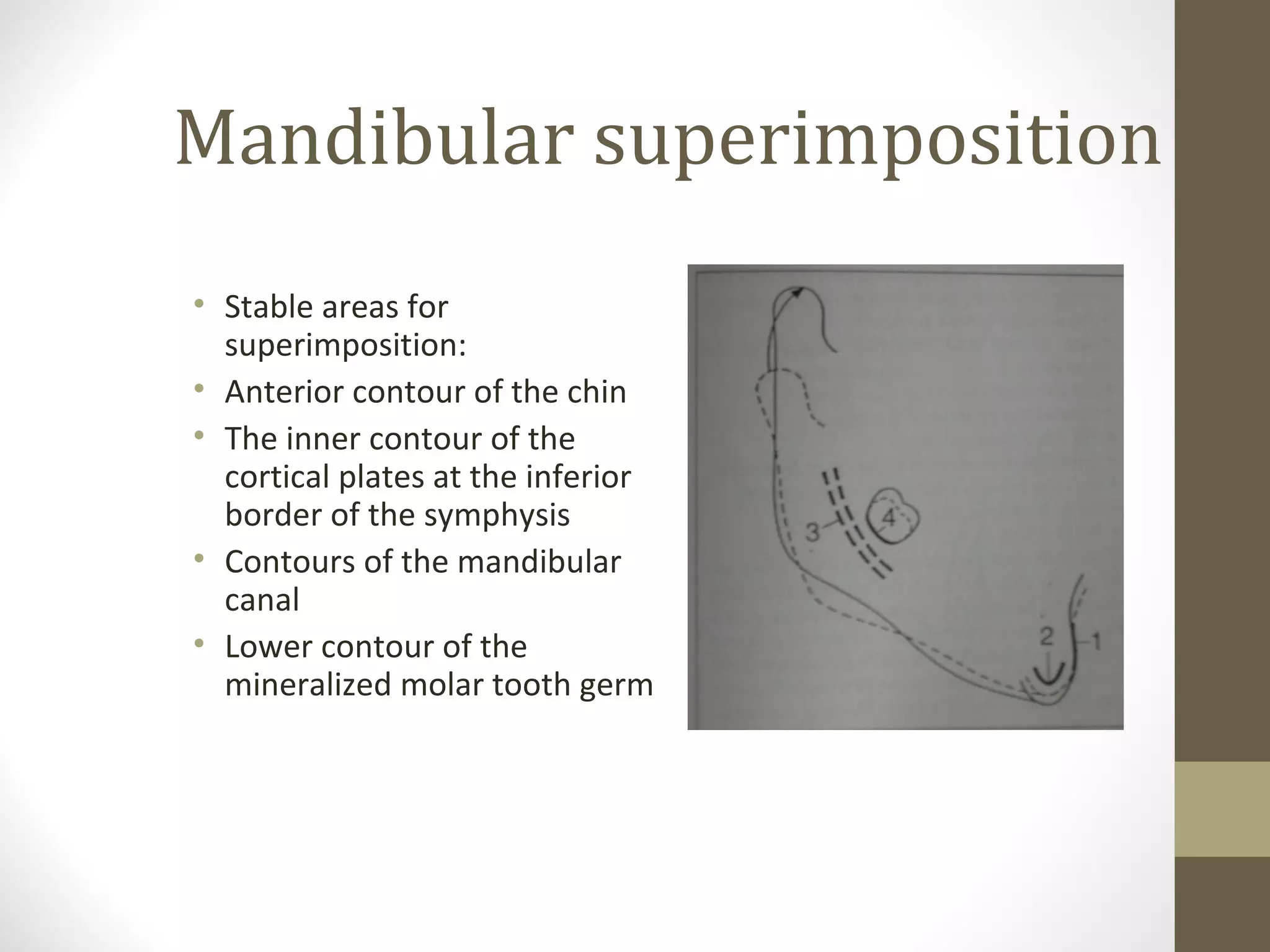 Superimposition techniques | PPT