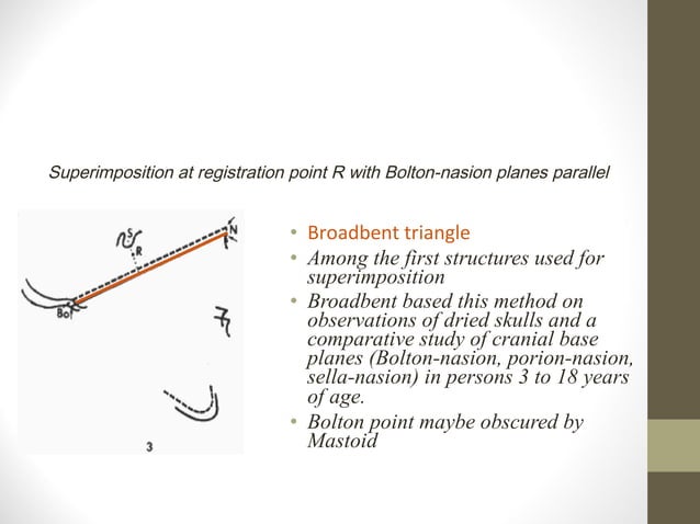 Superimposition techniques | PPT