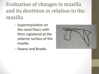 Superimposition techniques | PPT