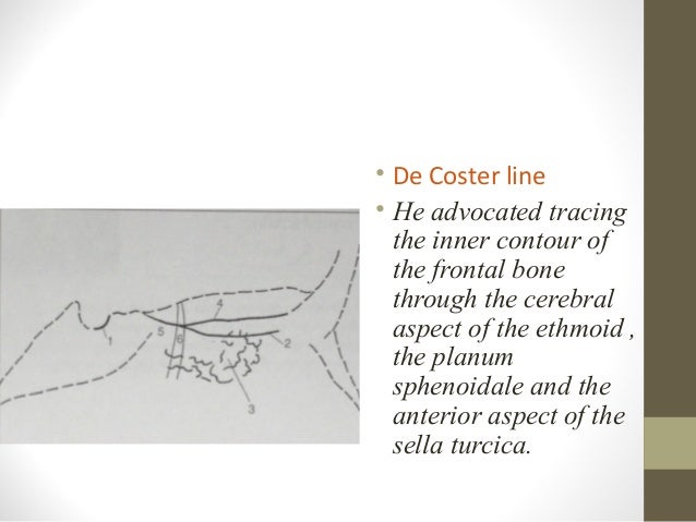 Superimposition techniques