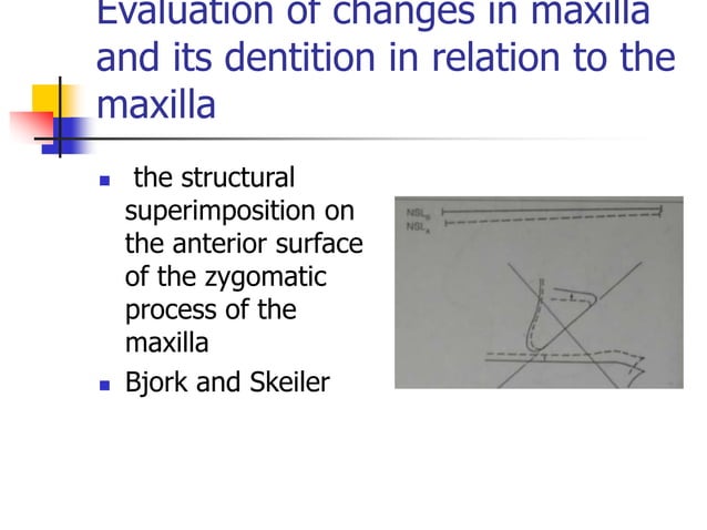 ORTHODONTICS SUPERIMPOSITION_TECHNIQUES.ppt