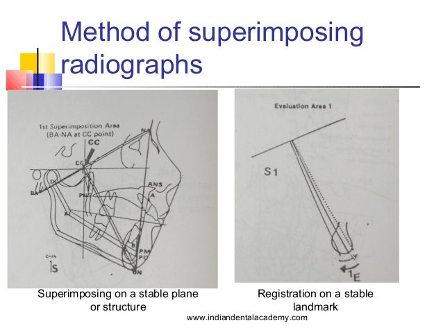 Superimposition techniques