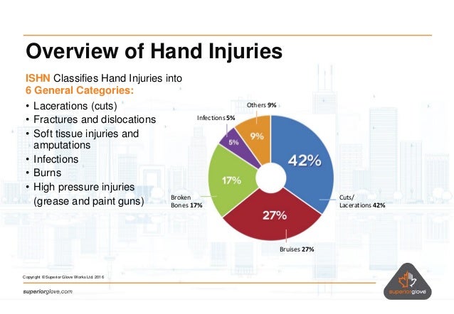 Superior Glove - New Standard for High Visibility and How it Applies